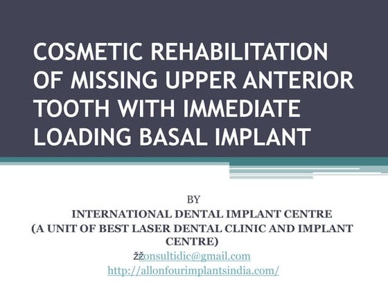 Immediate implant | PPT