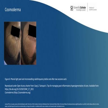 Cosmoderma (3).pptx