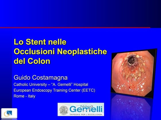 "No Anastomosis" Combined Colon Conduit and Colostomy Diversion with ...