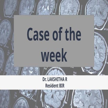 CoW hemispheric atrophy final.pptxbsbsbbzggzgs | PPTX