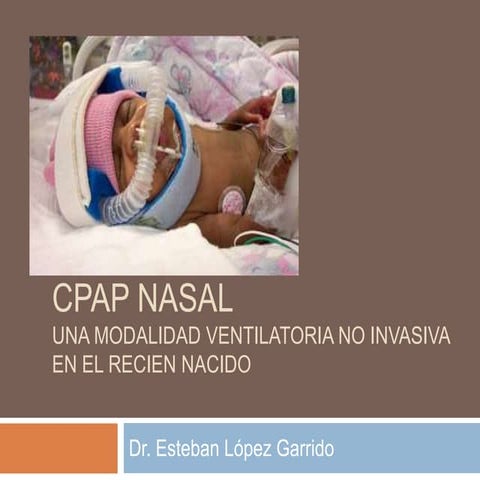 Cpap nasal en el recien nacido | PPTX