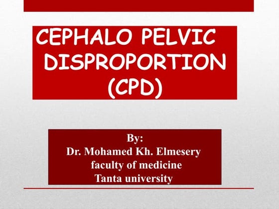 Cephalopelvic disproportion | PPTX