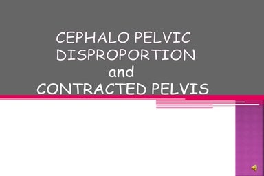 Cephalopelvic Disproportion Ppt