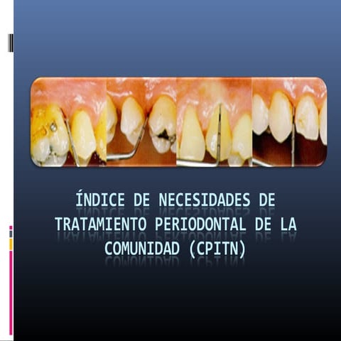 Cpitn | PPT