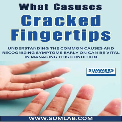 What causes cracked fingertips and how can I prevent them? | PDF