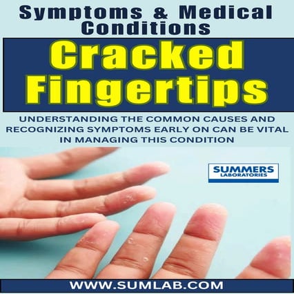 What deficiency causes cracked fingertips? | PDF