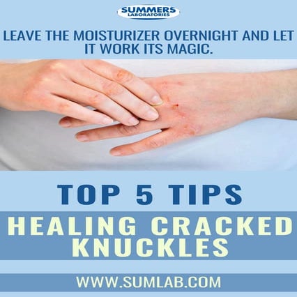 How do you fix cracked skin on your knuckles? | PDF
