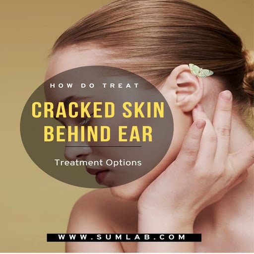 How do you treat cracked skin behind your ear? | PDF