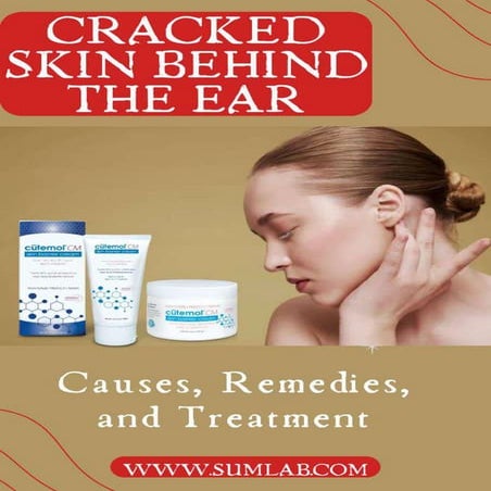 What is the best cream for cracked skin behind the ears? | PDF