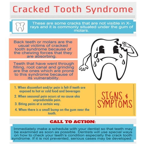 Cracked Tooth Syndrome | PDF