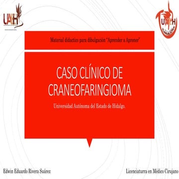 Craneofaringiomas | PPTX