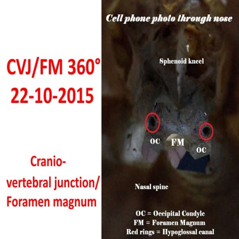 FORAMEN MAGNUM ANATOMY.pptx