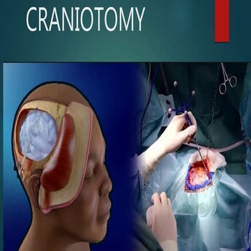 CRANIOTOMY.pptx