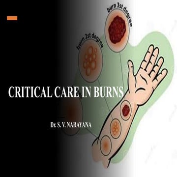 CRITICAL CARE IN BURNS PLATIC SURGERYpptx | PPTX
