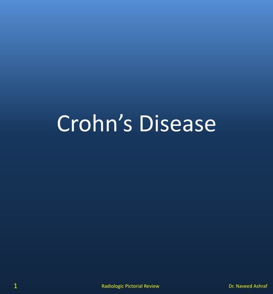 21 radiolucent metaphyseal bands | PPTX | Bone and Joint Conditions | Diseases and Conditions