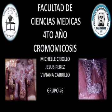 Cromomicosis | PPTX