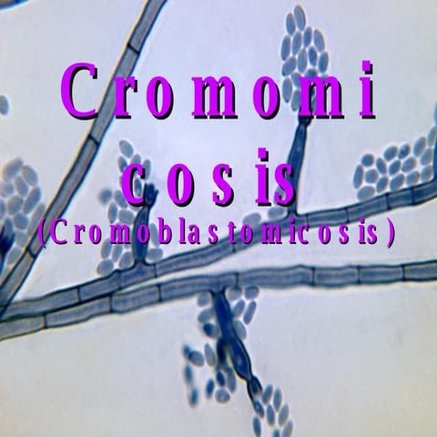Cromomicosis | PPT