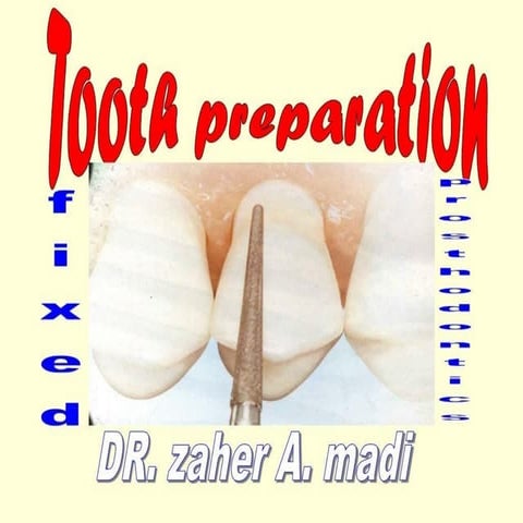 All ceramic crown preparation in dentistry .pptx