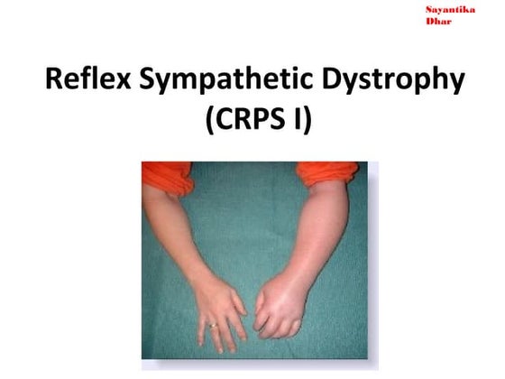 Colles' fracture & physiotherapy management | PPT