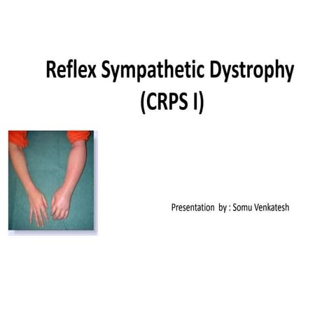 CRPS | PPT