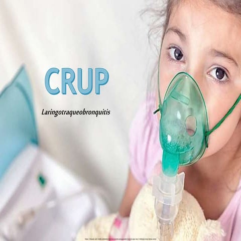Crup Laringotraqueobronquitis | PPTX