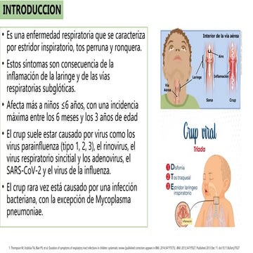 CRUP o laringotraqueitis aguda definición diagnóstico y manejo | PDF