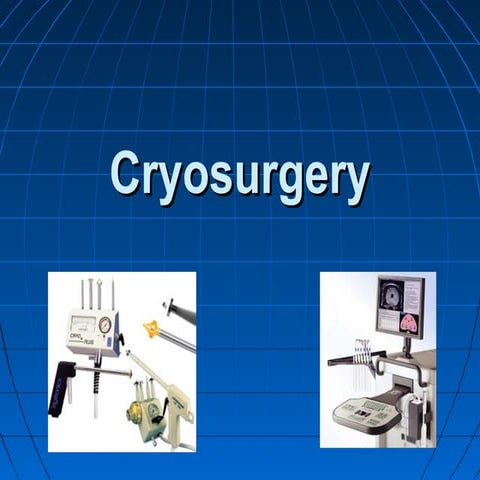 Cryosurgery | PPT