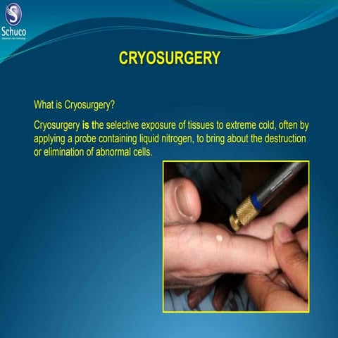 Cryosurgery | PPT