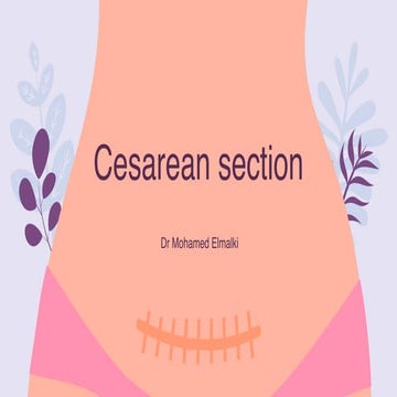 Caesarean section at Elobied teaching hospital .pdf