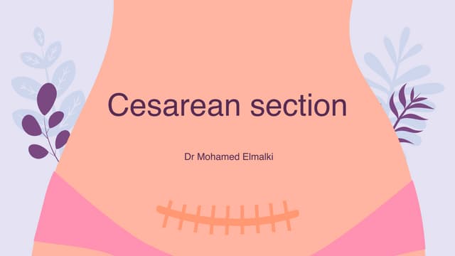 Caesarean section | PPTX