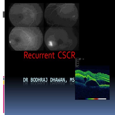 recurrent cscr | PPTX