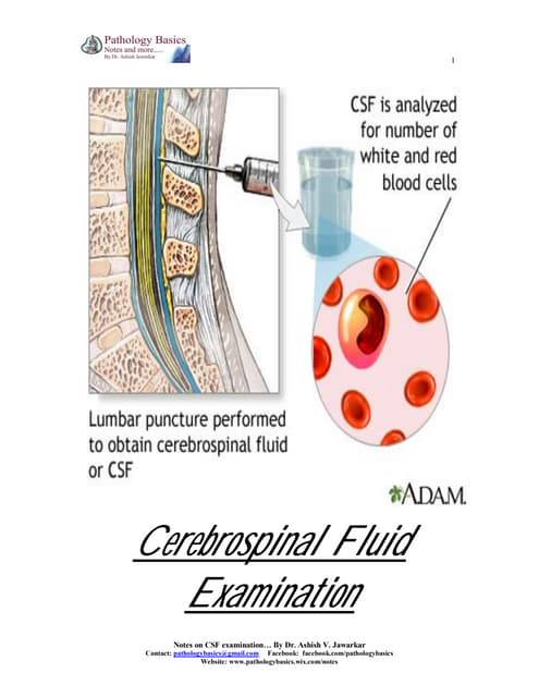 Cerebrospinal fluid (CSF) and interpreting lumbar puncture