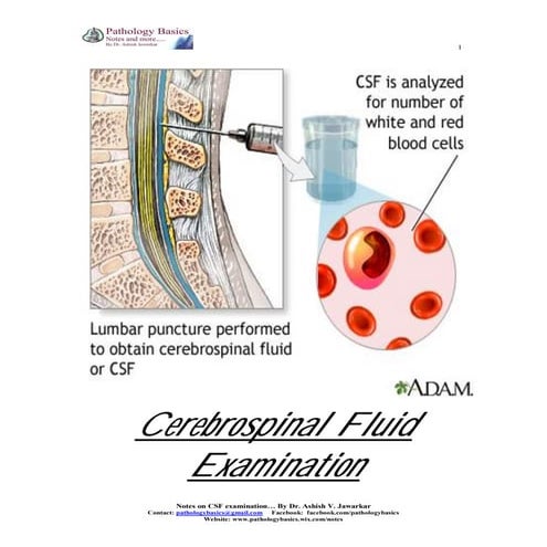 CSF - Cerebrospinal fluid examination - from tapping to pathological ...