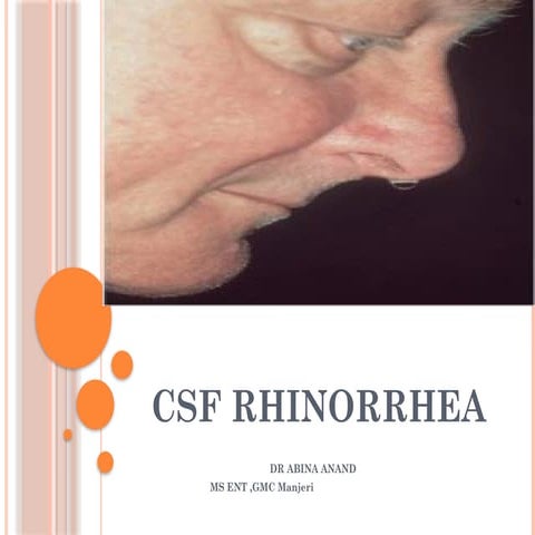 Cerebrospinal fluid rhinorrhea (CSF) | PPTX