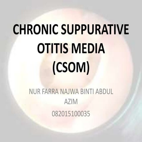 Csom, cholesteatoma | PPTX