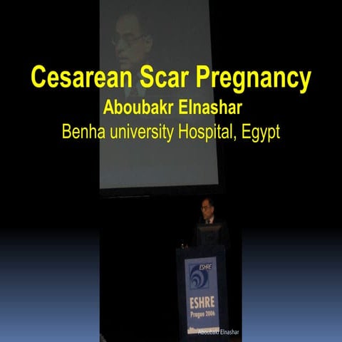 Cesarean Scar Pregnancy | PDF