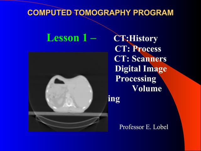 CT Image reconstruction | PPTX