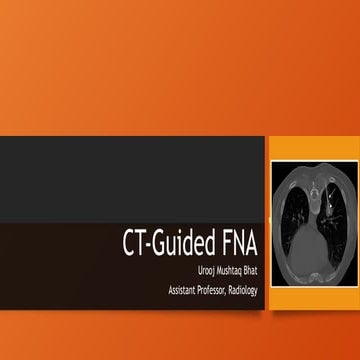 CT-Guided FNA by Urooj Mushtaq Bhat.pptx