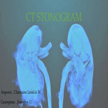 Ct stonogram-final-slide-share (Amponin & Carampatan) | PPTX