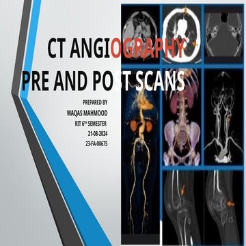 CT Lower Limb Angiography: Techniques, Indications, Protocols, Image ...