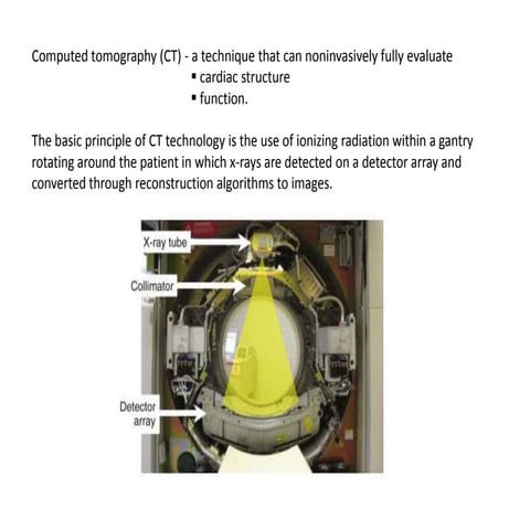 cardiovascular ct ppt | PPTX