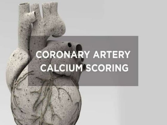 Coronary artery calcium scoring IDoR 2018 | PPT