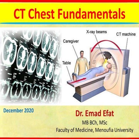 Ct chest fundamentals | PDF