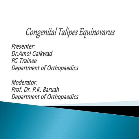 Congenital talipes equinovarus (club foot/ctev) ppt by Dr Pratik | PPTX
