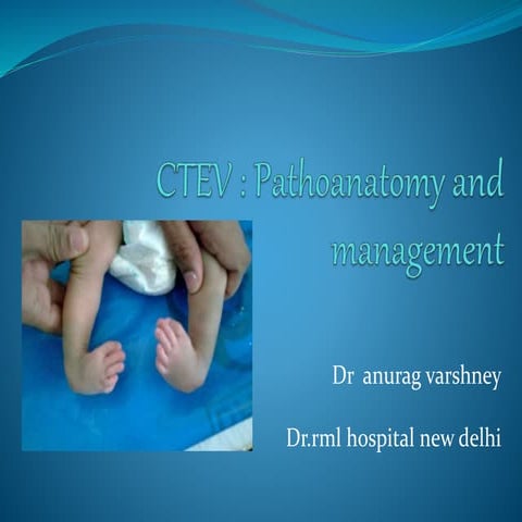 Ctev with dr anurag (anurag_rog@yahoo.com) | PPTX