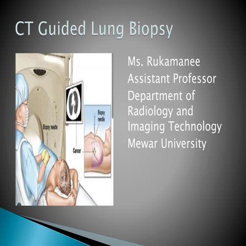 CT GUIDED LUNG BIOPSY.pptx,lung mass is malignant (cancerous) or benign ...
