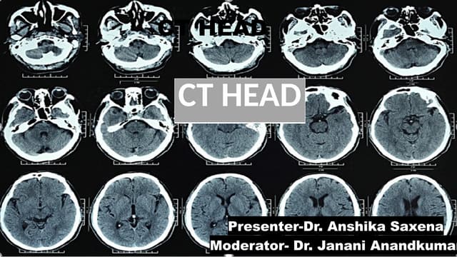 Normal CT BRAIN | PPTX