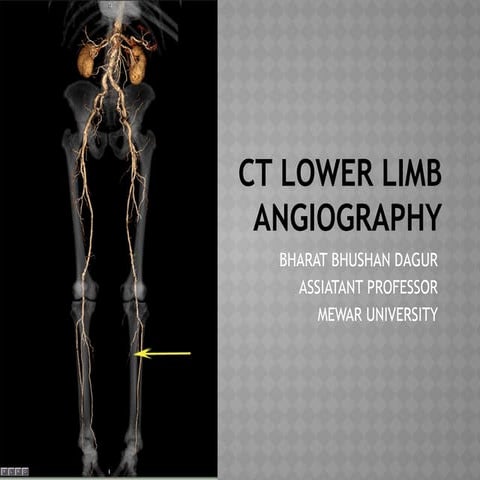 CT Lower Limb Angiography: Techniques, Indications, Protocols, Image ...