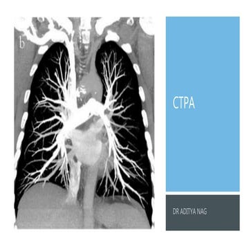 CT PA | PPTX | Lung and Respiratory Health | Diseases and Conditions