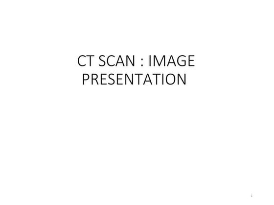 Post processing of computed tomography | PPTX